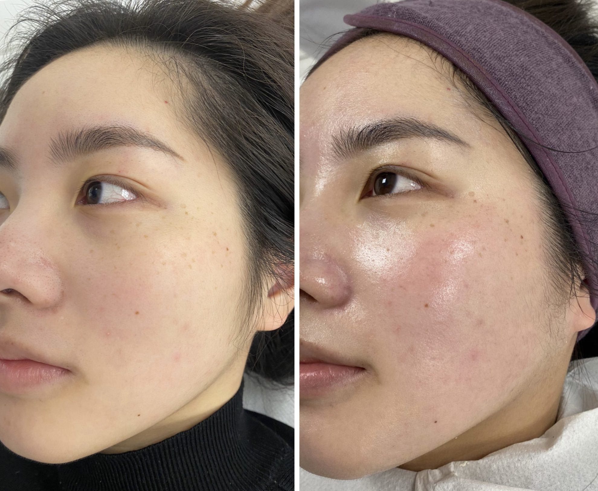 Facials – FeonixAesthetics